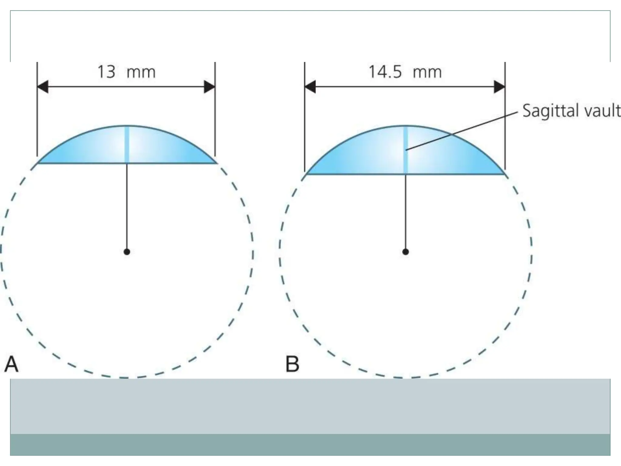 contact lens terminology some basic definitions | PPTX