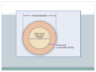 contact lens terminology some basic definitions | PPTX