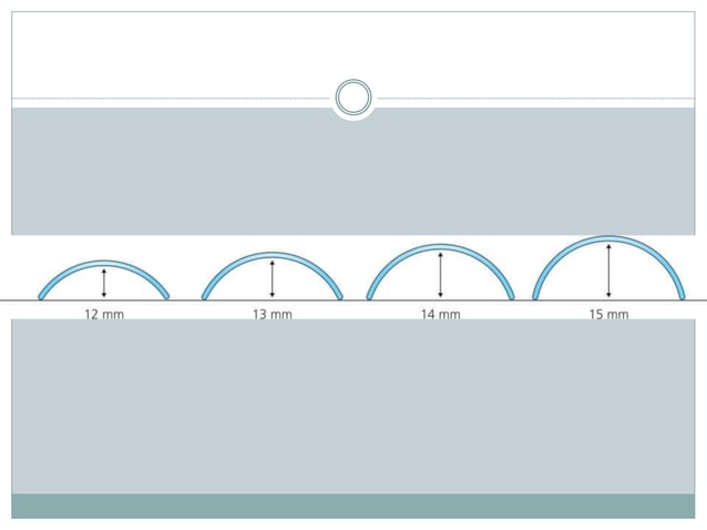 contact lens terminology some basic definitions | PPTX