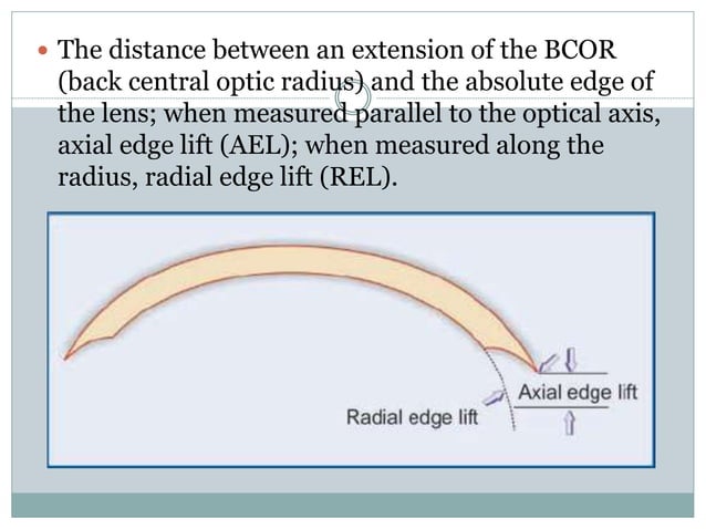 contact lens terminology some basic definitions | PPTX