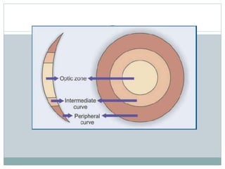 contact lens terminology some basic definitions | PPTX