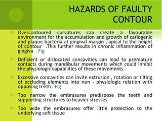 Contacts and contours | PPT