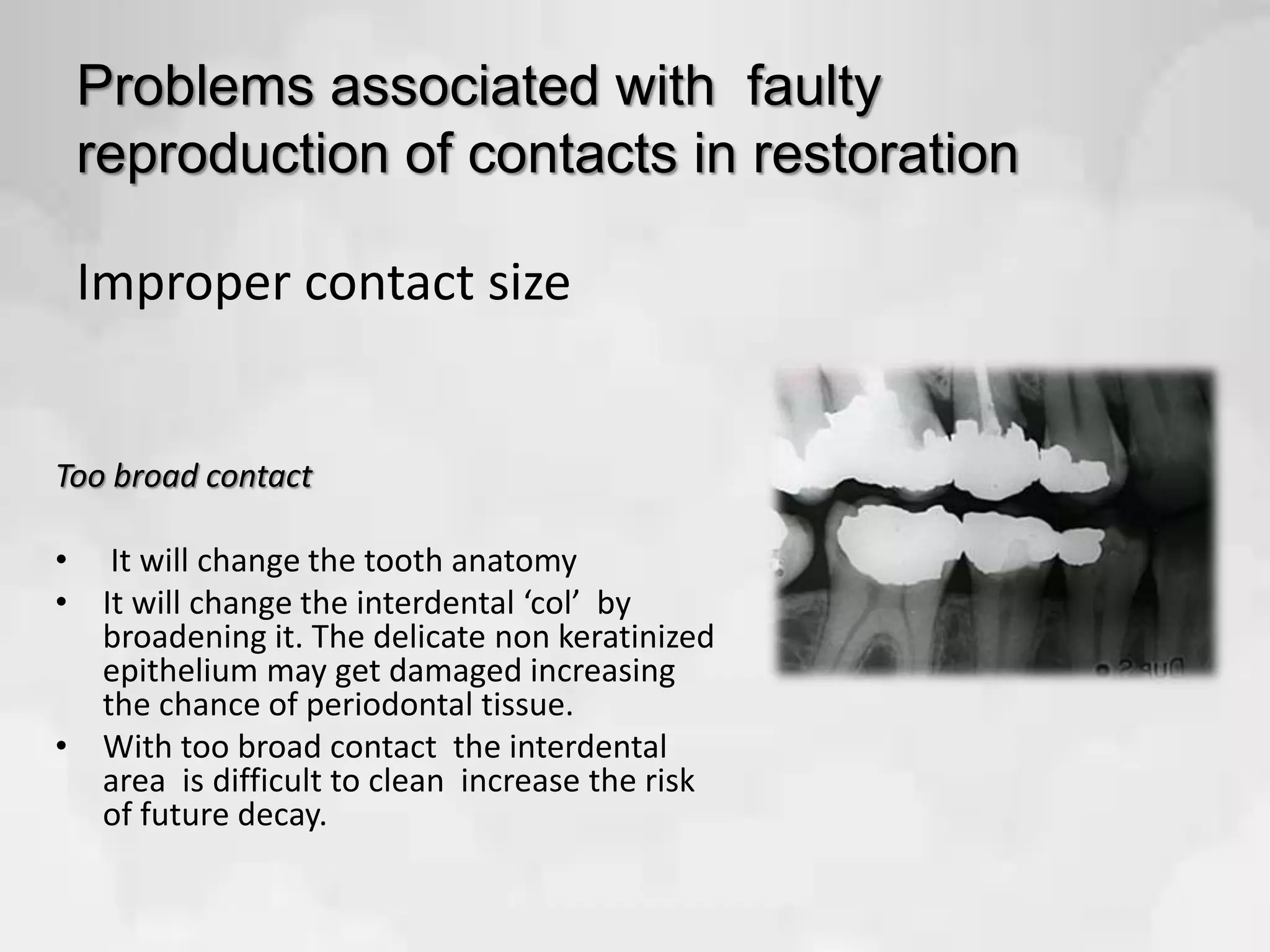 Contacts and contours | PPTX