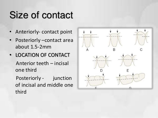 Contacts and contours