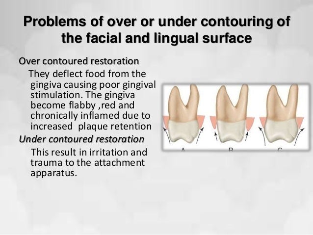 Contacts and contours