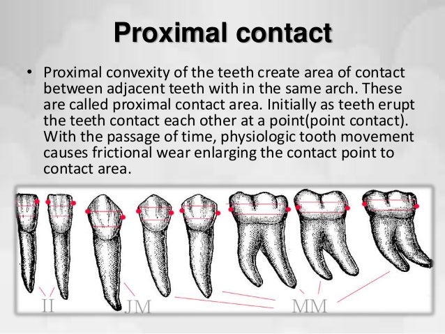 Contacts and contours