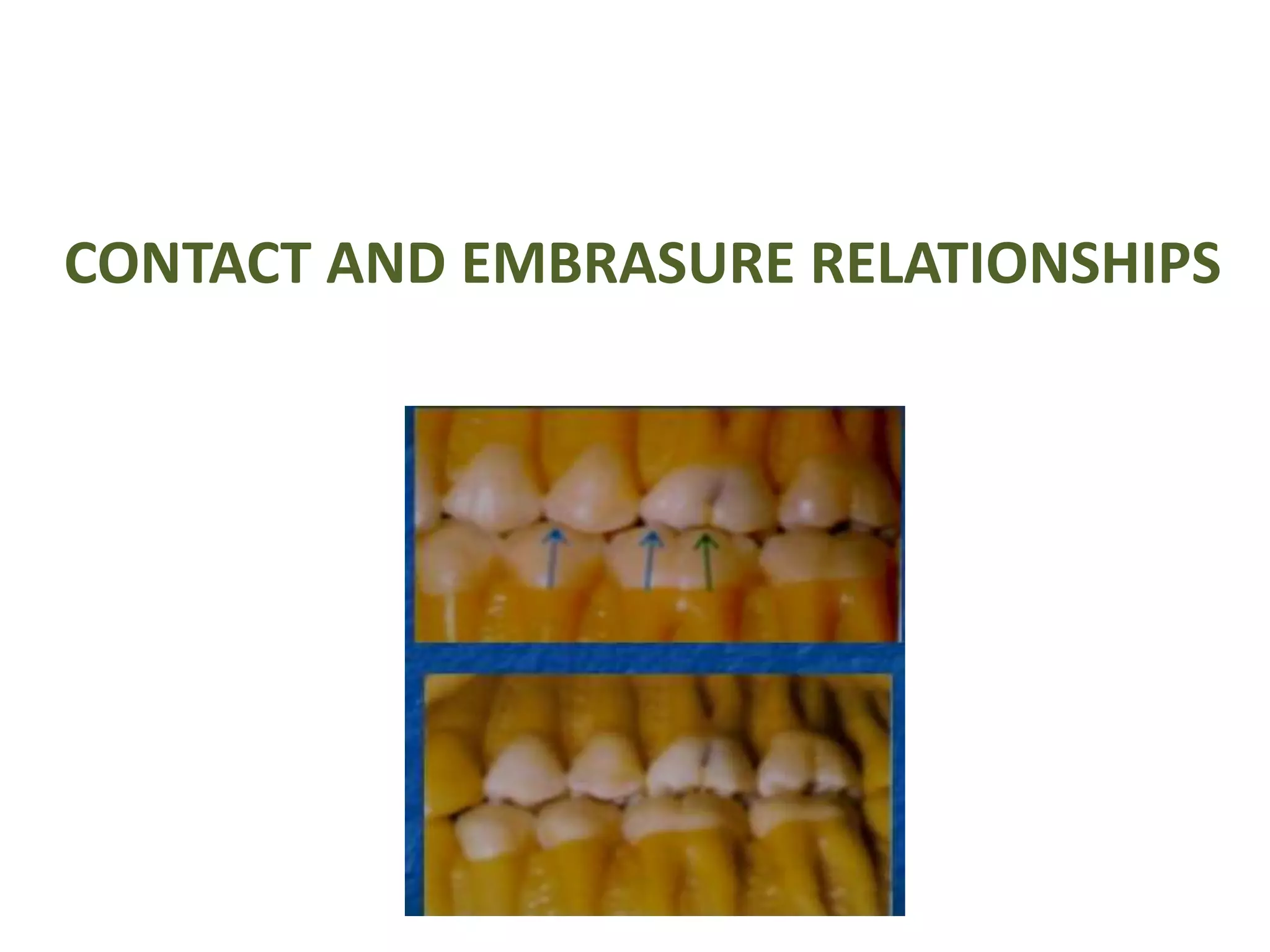 Contacts and Contours | PPTX