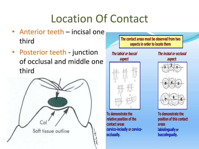 Contacts and Contours | PPTX | Dental Health | Diseases and Conditions