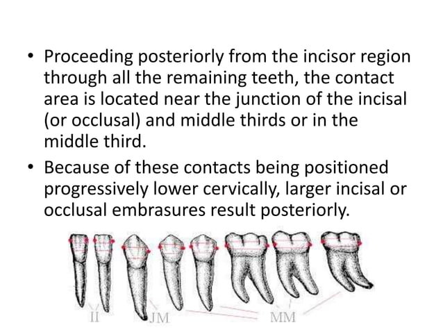 Contacts and Contours | PPTX | Dental Health | Diseases and Conditions