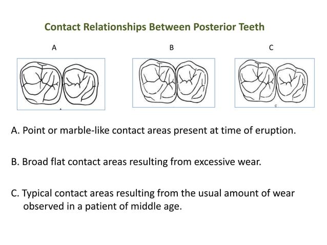 Contacts and Contours | PPTX | Dental Health | Diseases and Conditions
