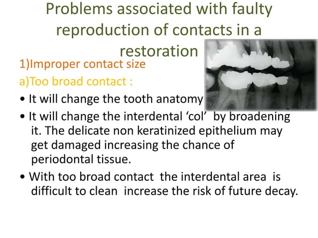 Contacts and Contours | PPTX | Dental Health | Diseases and Conditions