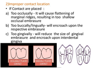 Contacts and Contours | PPTX