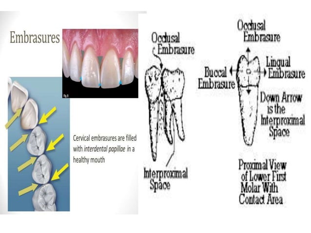 Contacts and Contours | PPTX | Dental Health | Diseases and Conditions