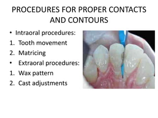Contacts and Contours | PPTX
