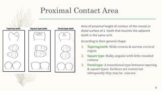 Contacts and Contours in Conservative Dentistry | PPT