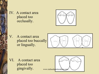 Contacts & contours/ practice dentistry
