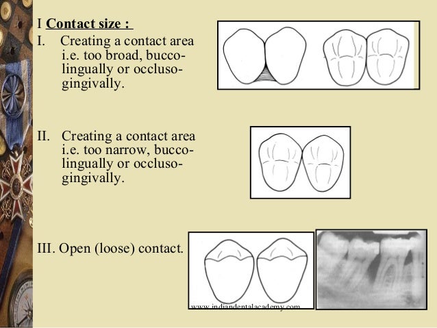 Contacts & contours/ practice dentistry