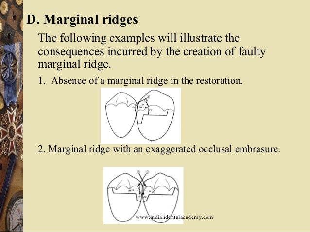 Contacts & contours/ practice dentistry
