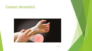 Contact stomatitis and dermatitis | PPTX
