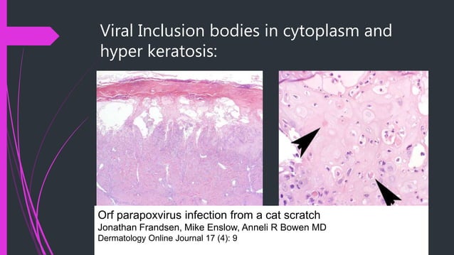 Contagious ecthyma | PPT
