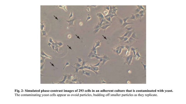 CONTAMINANTS IN CELL CULTURE & PRECAUTIONS.pptx | Infectious Diseases ...
