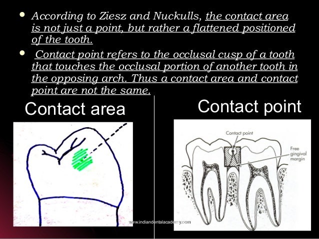 Contatcs and contours/ esthetic dentistry programs