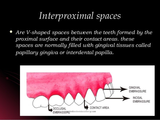 Contatcs and contours/ esthetic dentistry programs