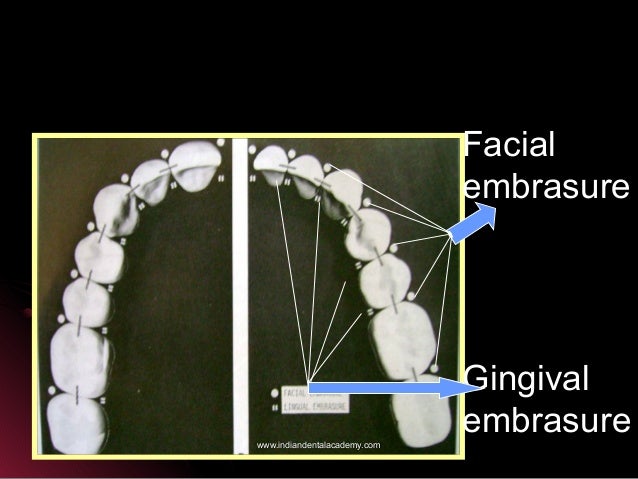 Contatcs and contours/ esthetic dentistry programs