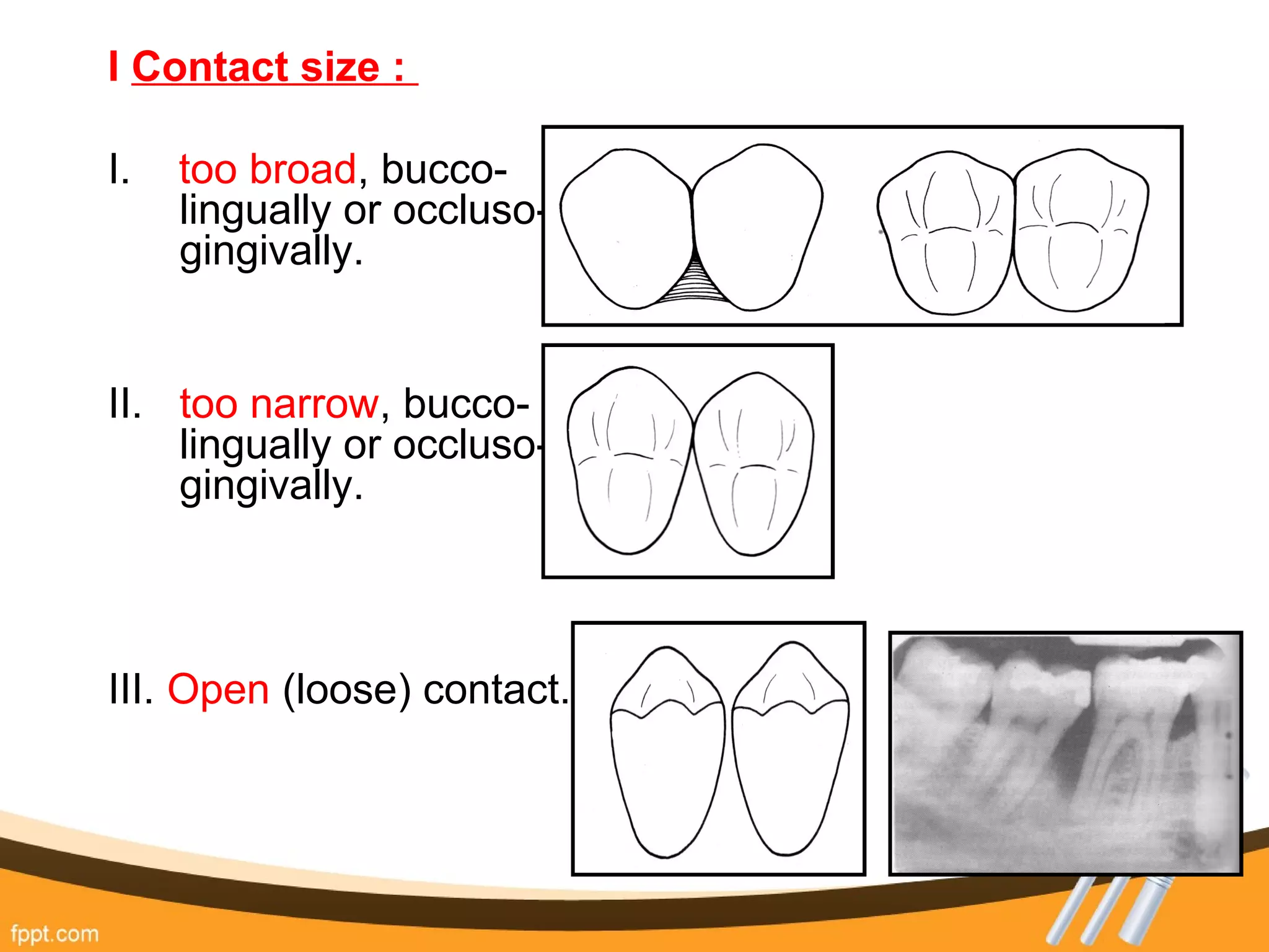 Contacts and Contours by Dr. Jagadeesh Kodithyala | PPT
