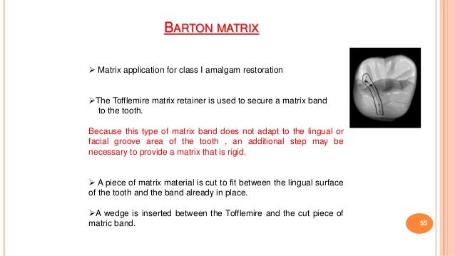 Contacts and contours