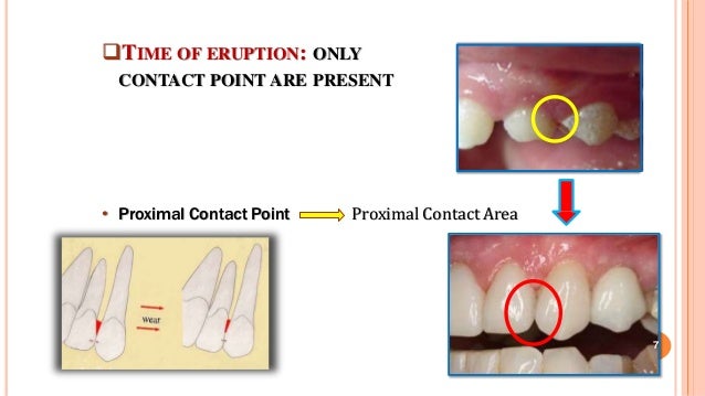 Contacts and contours