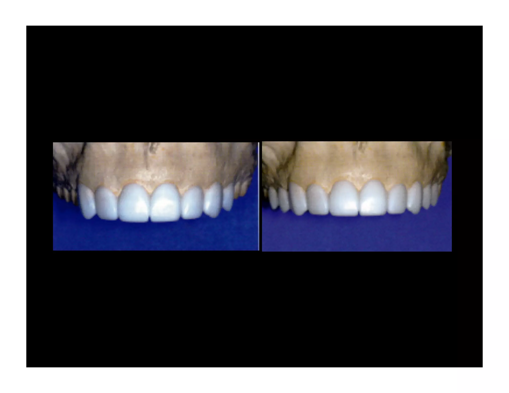 Contemporary aesthetic restorative procedure | PDF