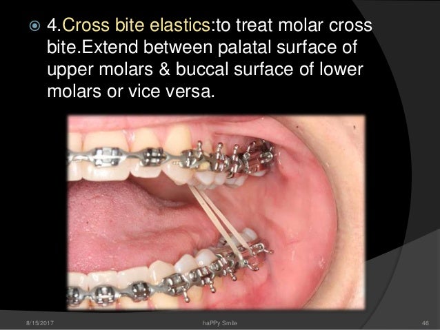 Contemporary Fixed Orthodontics
