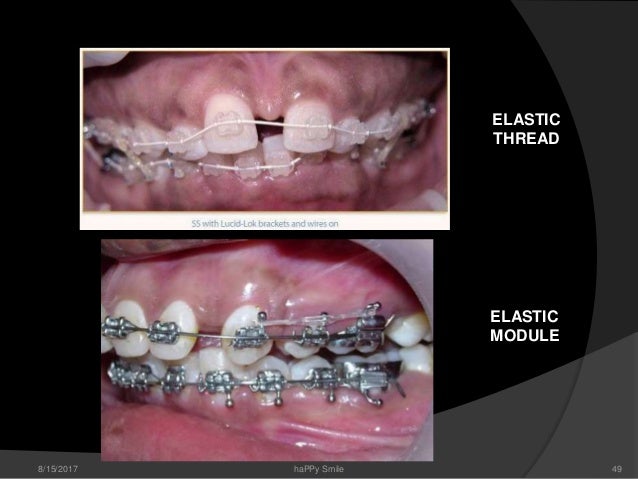 Contemporary Fixed Orthodontics