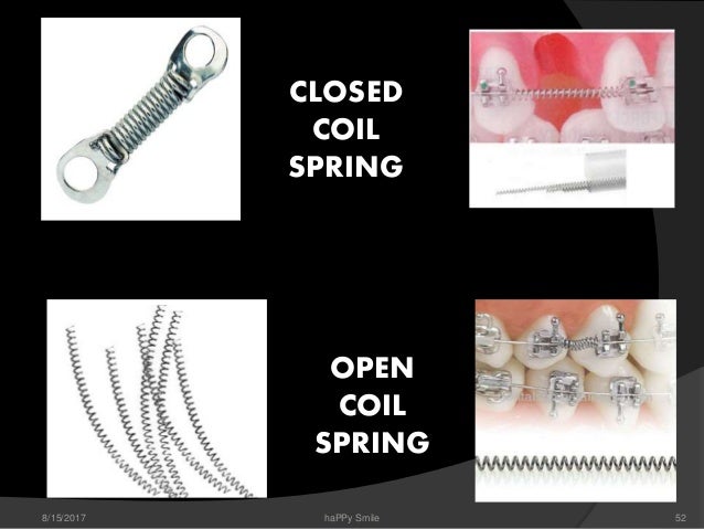 Contemporary Fixed Orthodontics