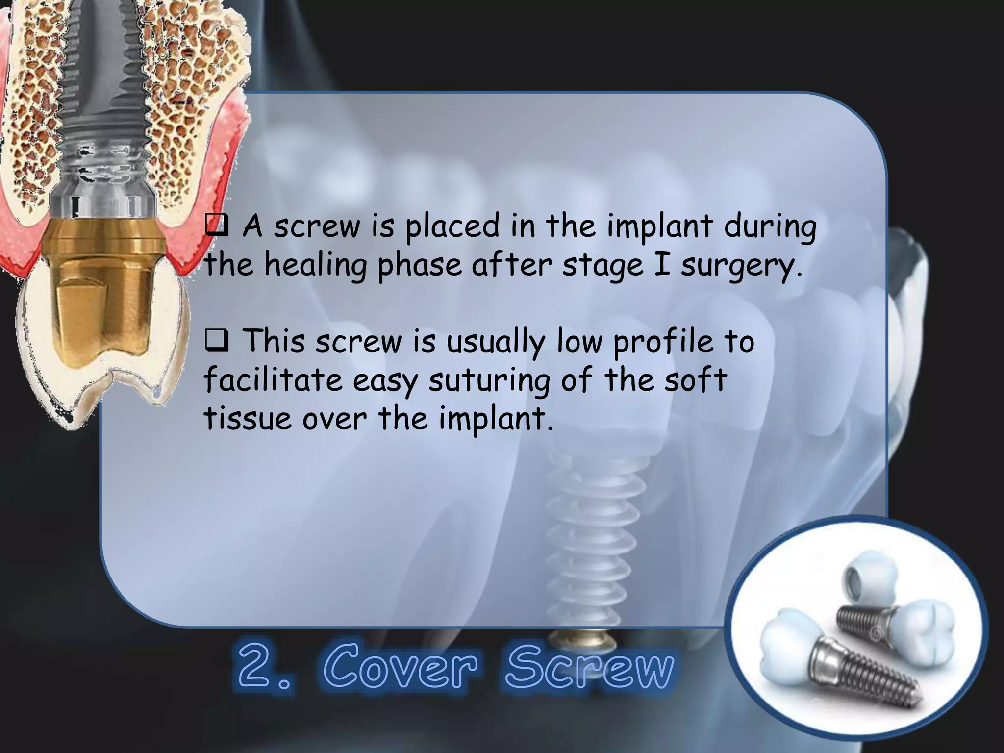 Contemporary implant dentistry | PPTX