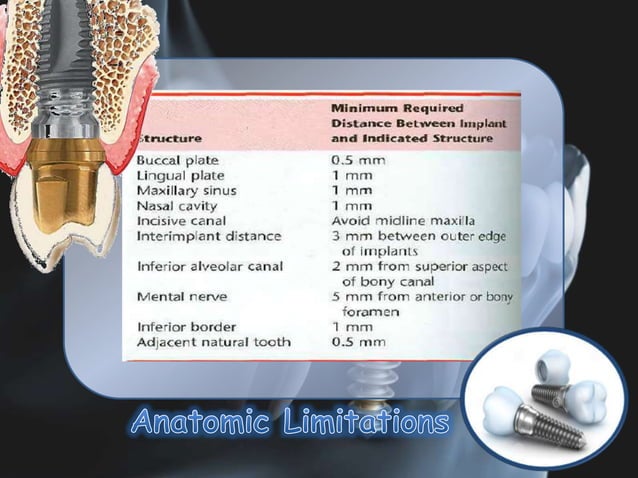 Contemporary implant dentistry | PPTX