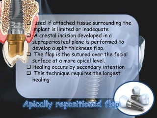 Contemporary implant dentistry | PPTX