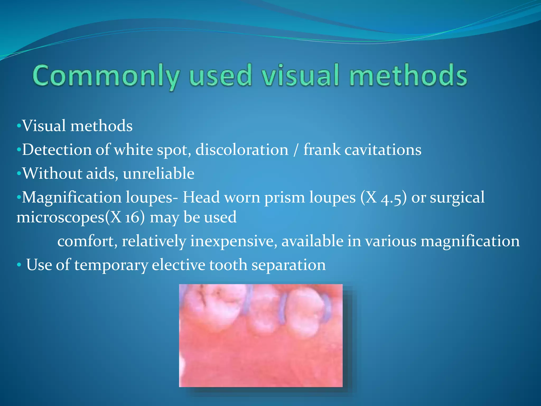 Contemporary Methods of Caries Detection | PPTX