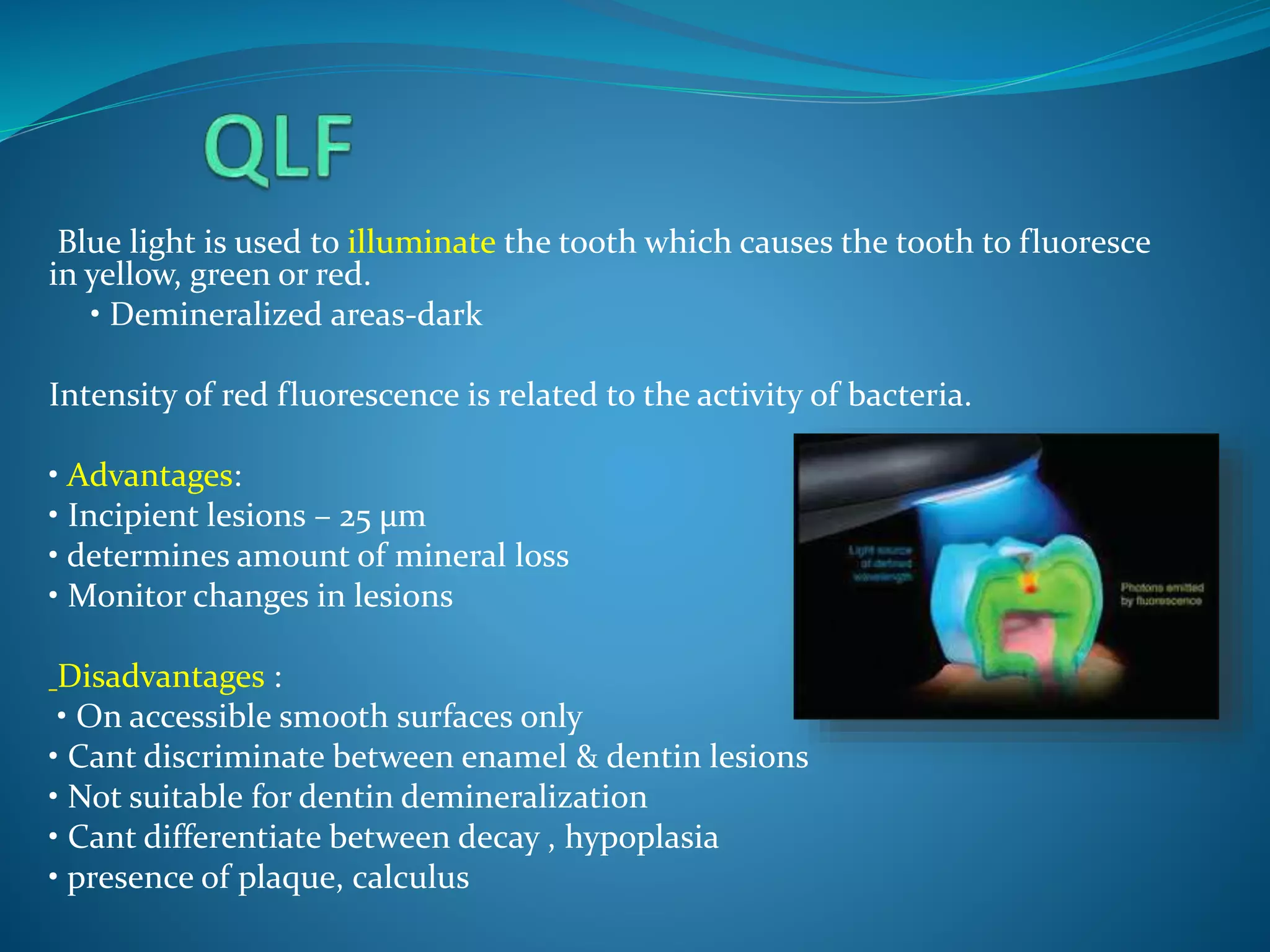 Contemporary Methods of Caries Detection | PPTX