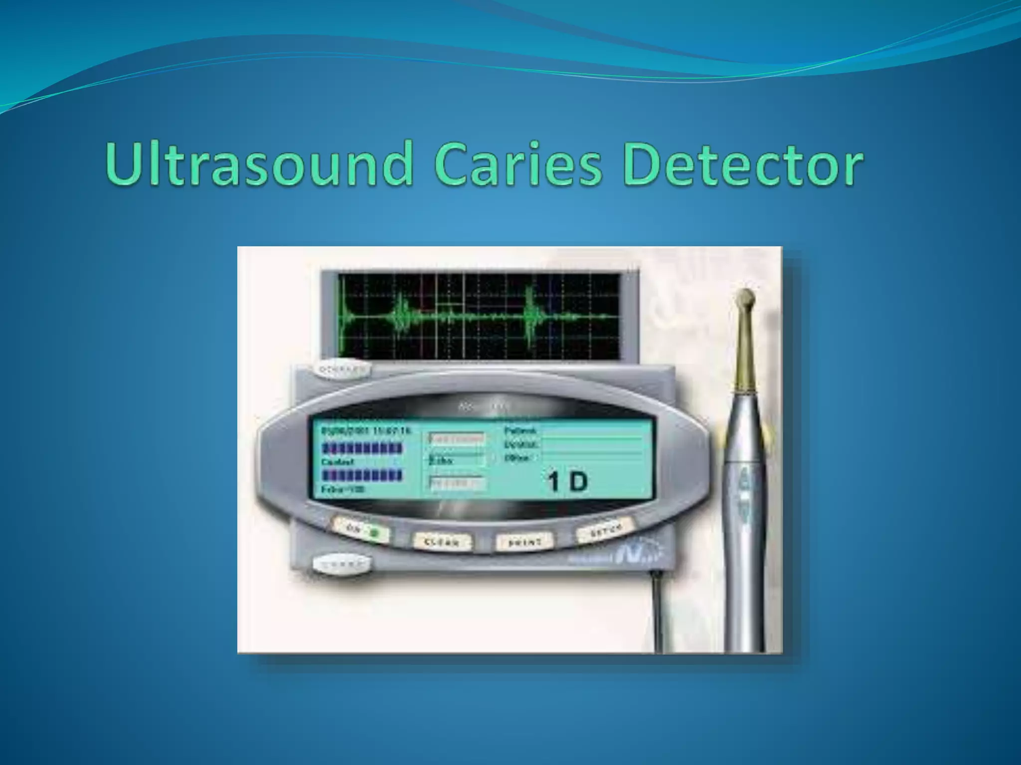 Contemporary Methods of Caries Detection | PPTX