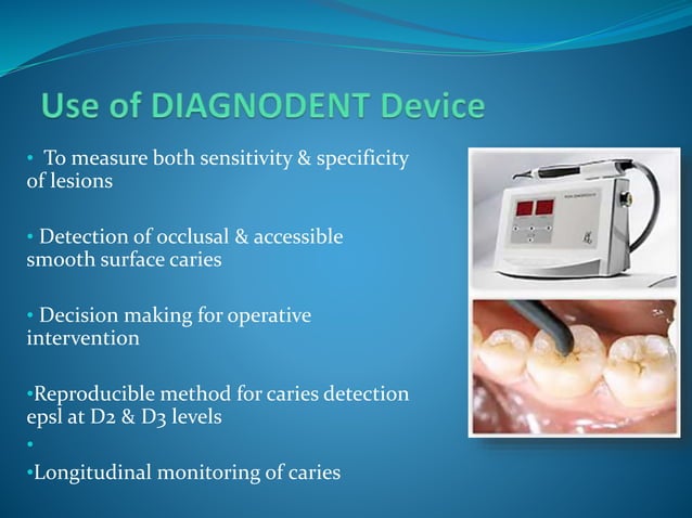 Contemporary Methods of Caries Detection | PPTX