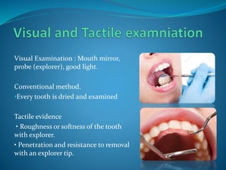 Contemporary Methods of Caries Detection | PPTX