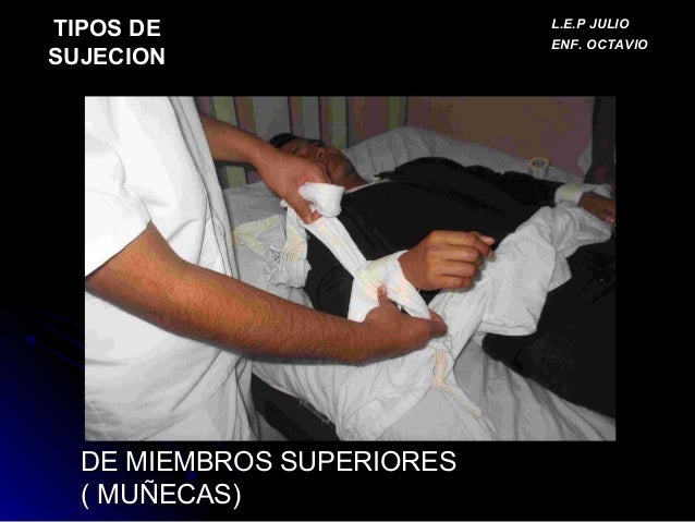 Contención mecánica