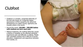 Contest doc 3d_printed_ponseti_cast | PPTX