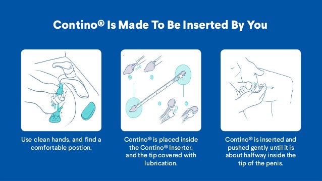 How To Inhibit Urine Flow In Men By Using Contino