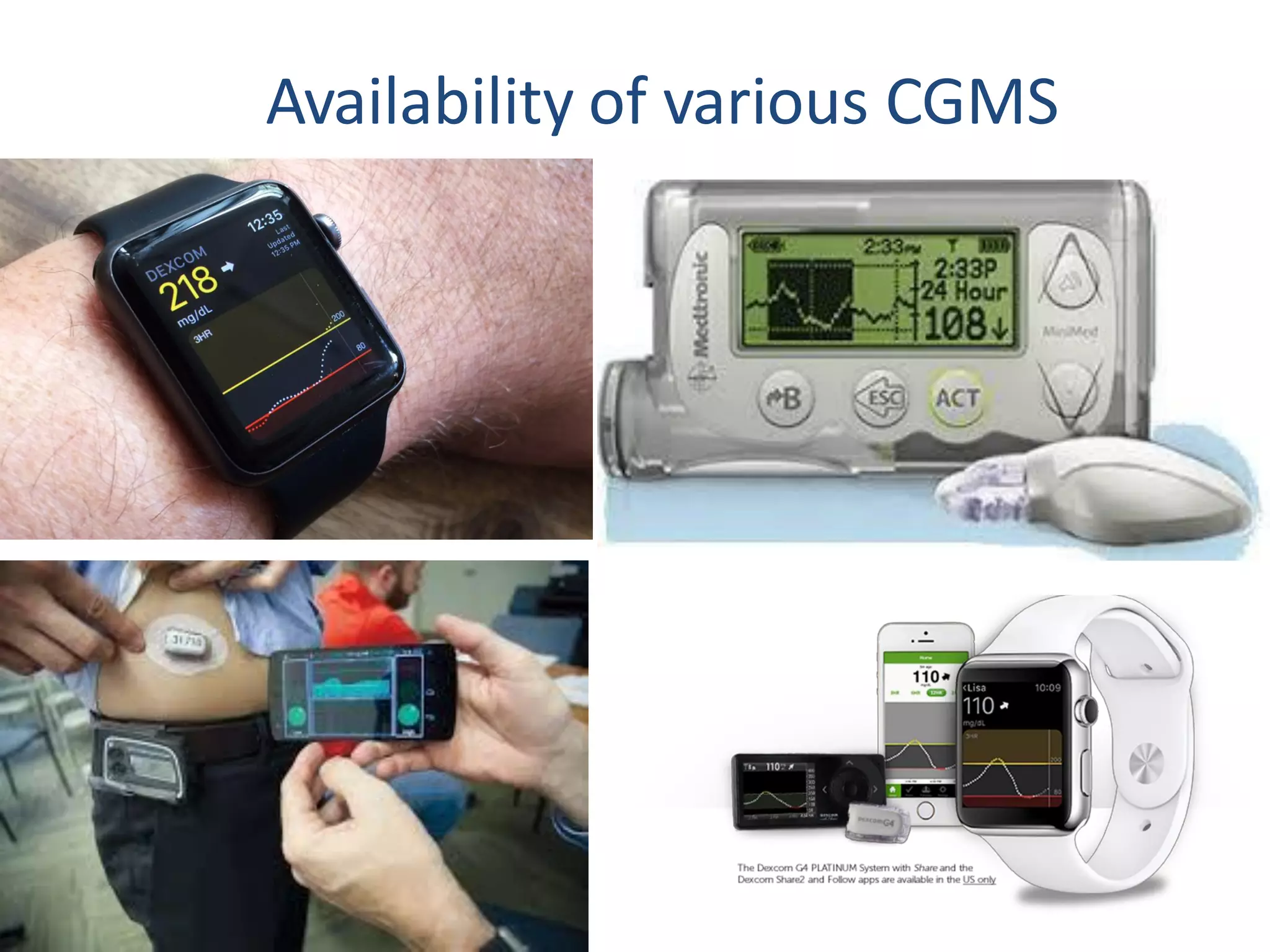 Continuous glucose monitoring technology | PDF