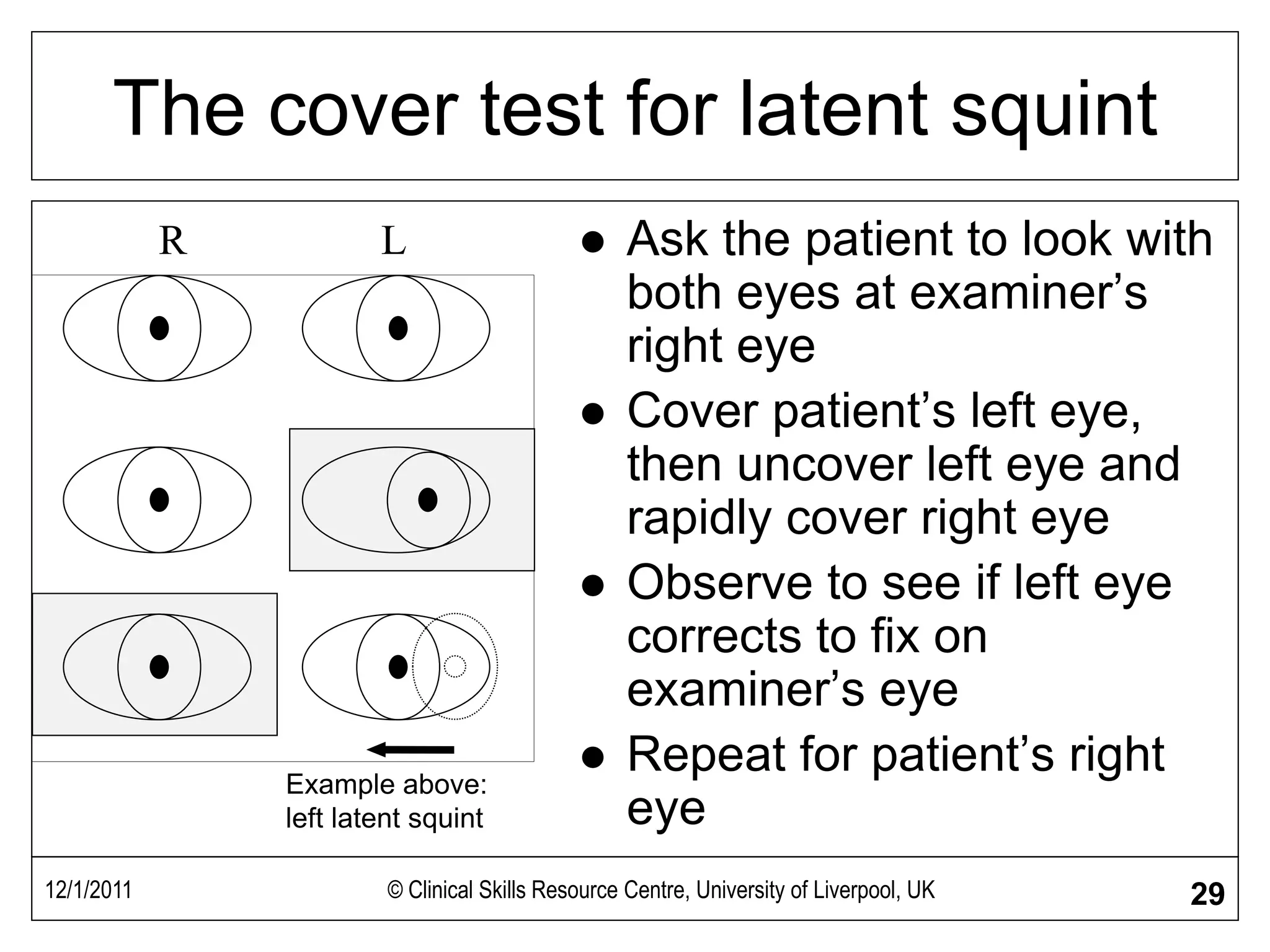 Continuation of Cranial Nerve Exam | PDF | Eye and Vision Conditions ...