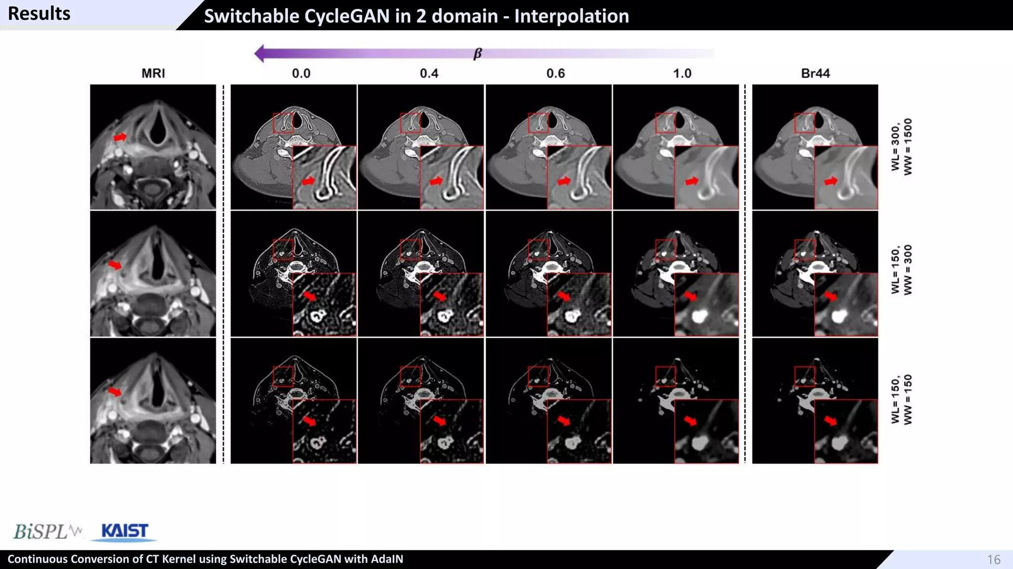 Continuous Conversion of CT Kernel using Switchable CycleGAN with AdaIN ...
