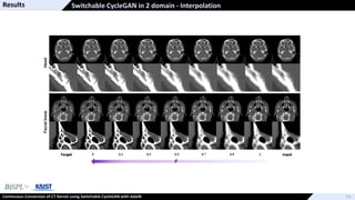 Continuous Conversion of CT Kernel using Switchable CycleGAN with AdaIN ...